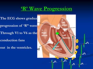 Ecg presentation | PDF