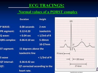 Ecg presentation | PDF