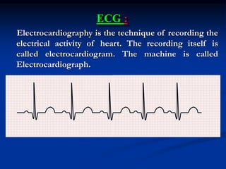 Ecg presentation | PDF