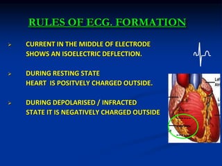 Ecg presentation | PDF