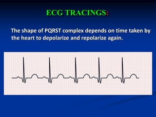 Ecg presentation | PDF