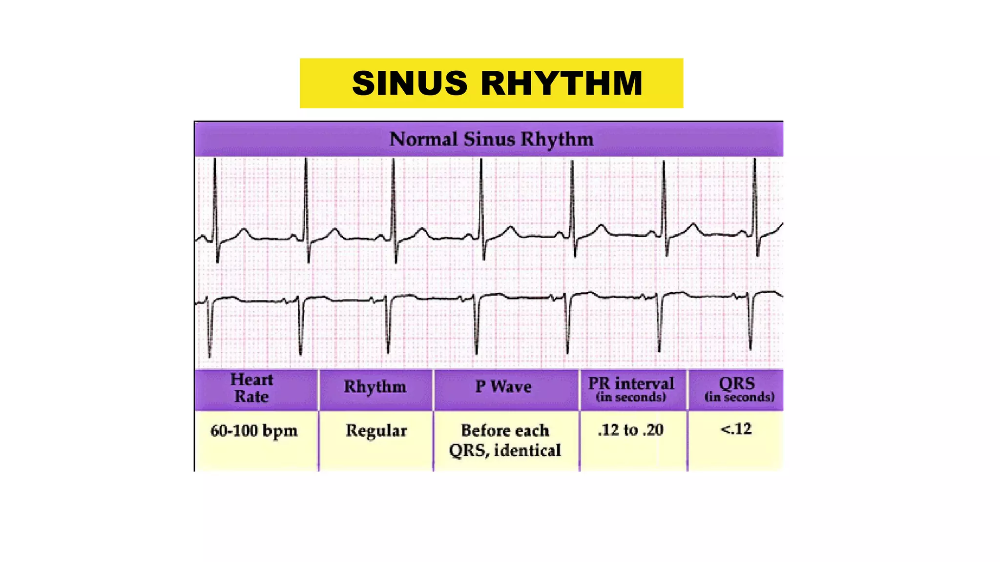 Ecg presentation | PPT