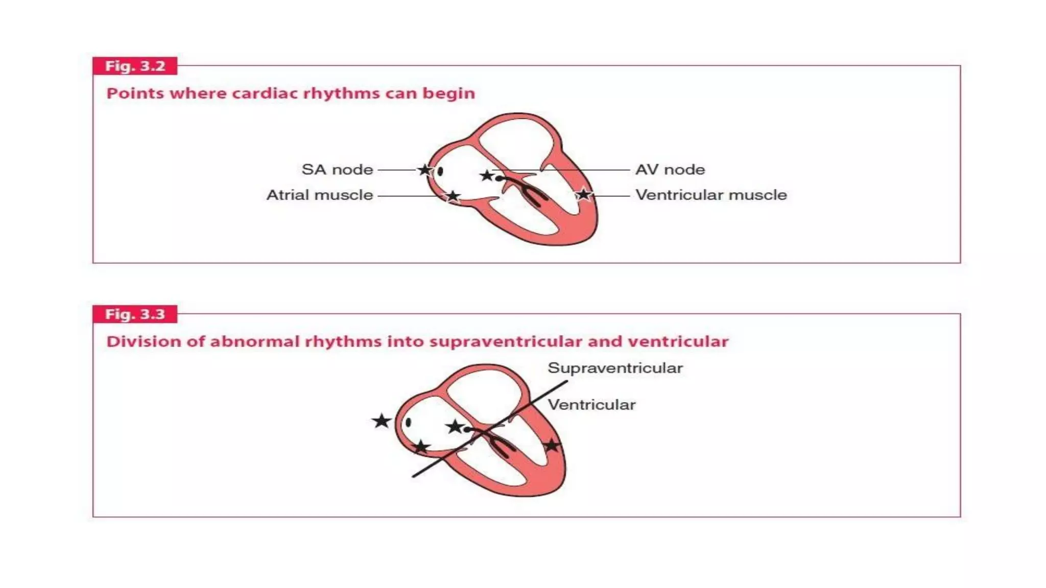 Ecg presentation | PPT