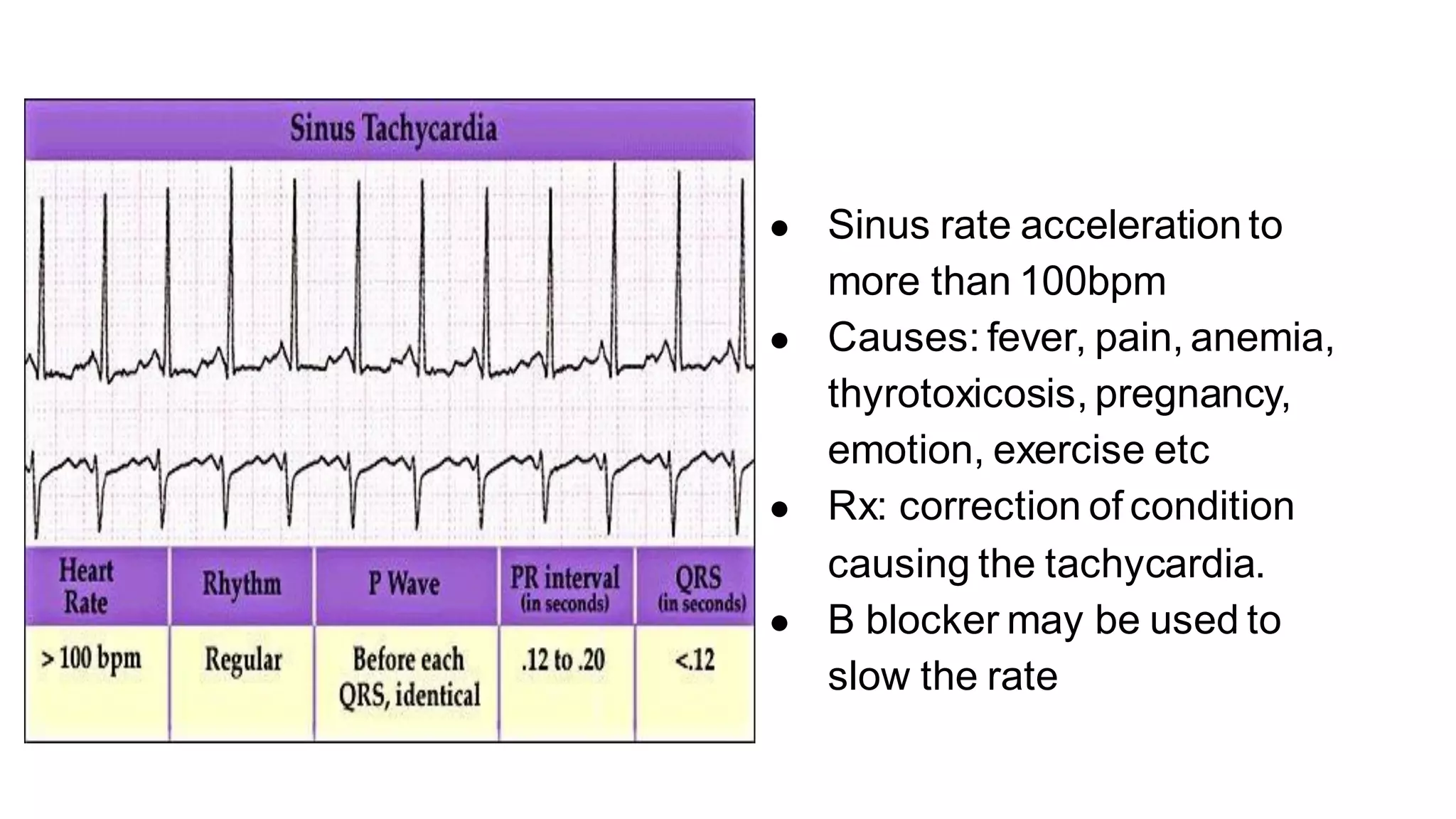 Ecg presentation | PPT