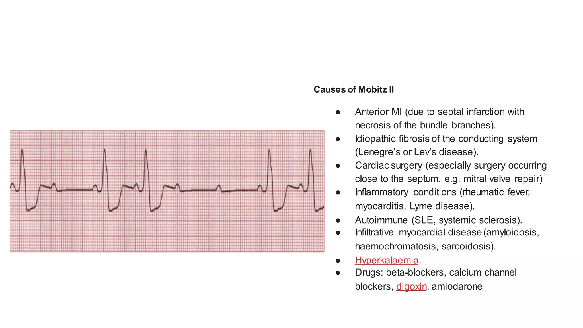 Ecg presentation | PPT