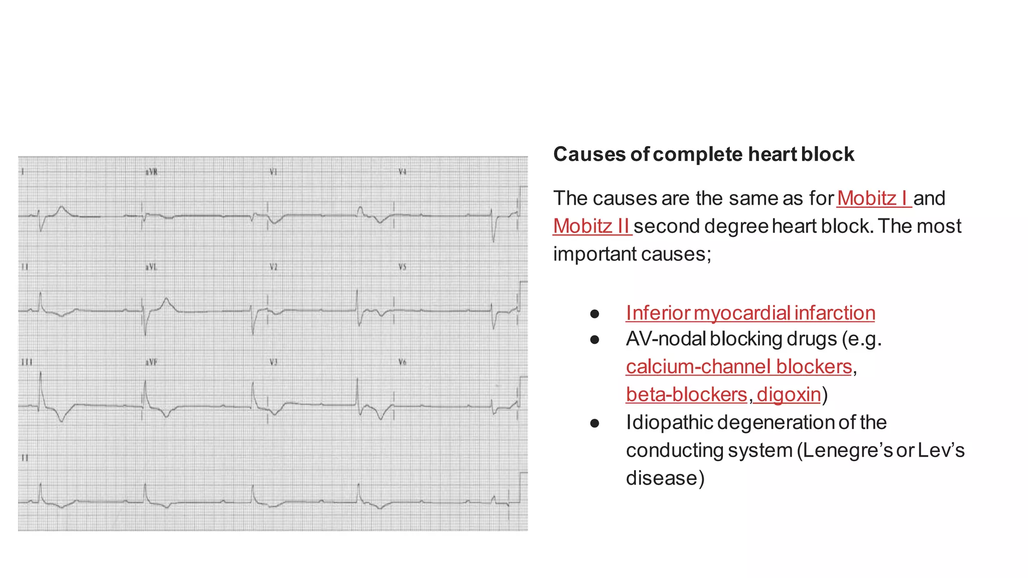 Ecg presentation | PPT