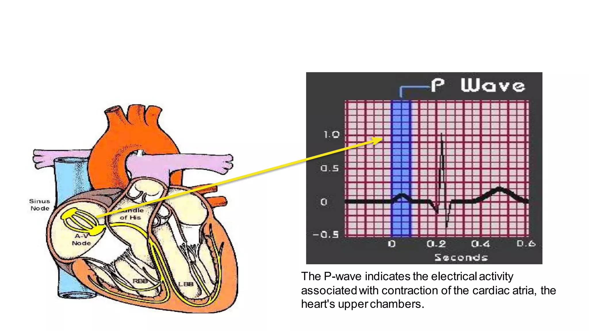Ecg presentation | PPT