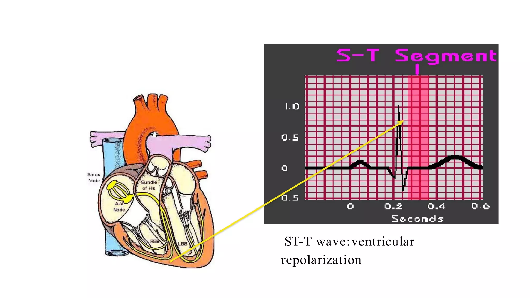 Ecg presentation | PPT