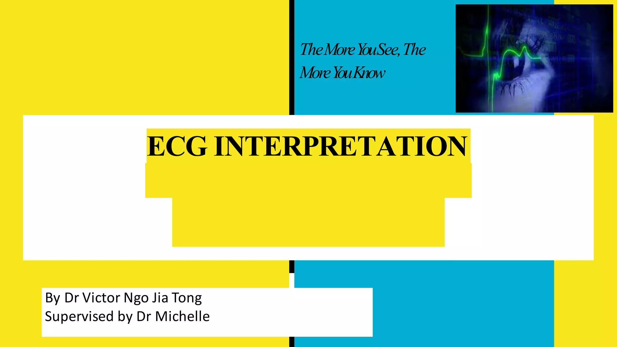 Ecg presentation | PPT