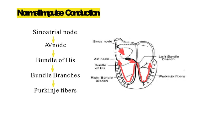Ecg presentation | PPT