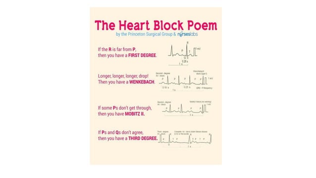 Ecg presentation | PPT