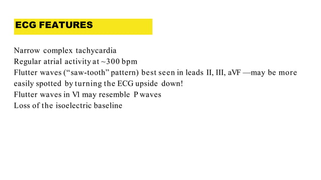 Ecg presentation | PPT