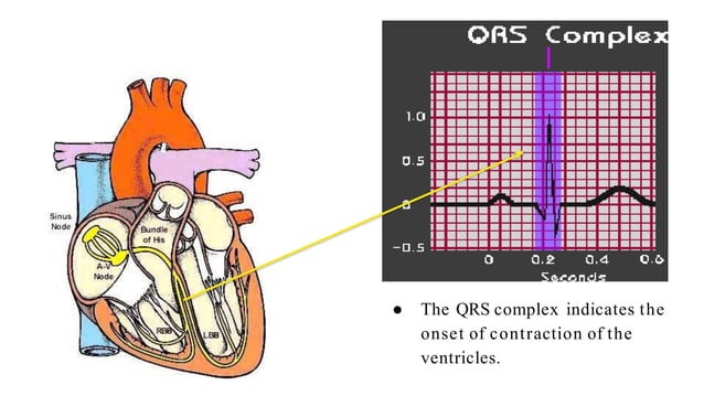 Ecg presentation | PPT