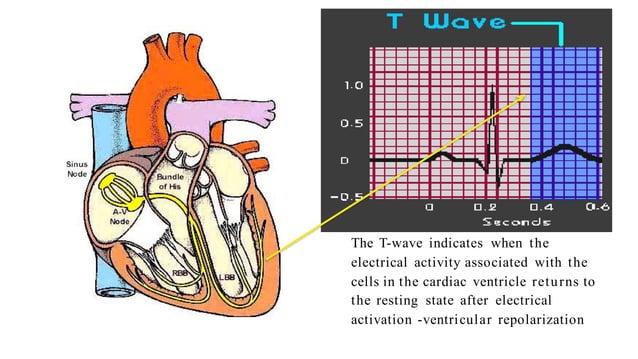 Ecg presentation | PPT