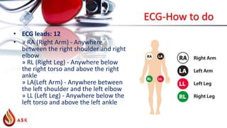 ECG | PPT