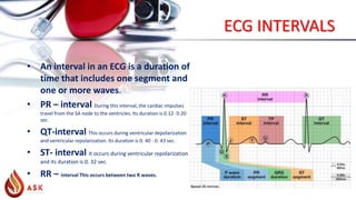 ECG | PPTX