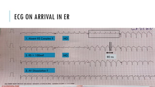ECG ElectroCardiography Presentation.pptx