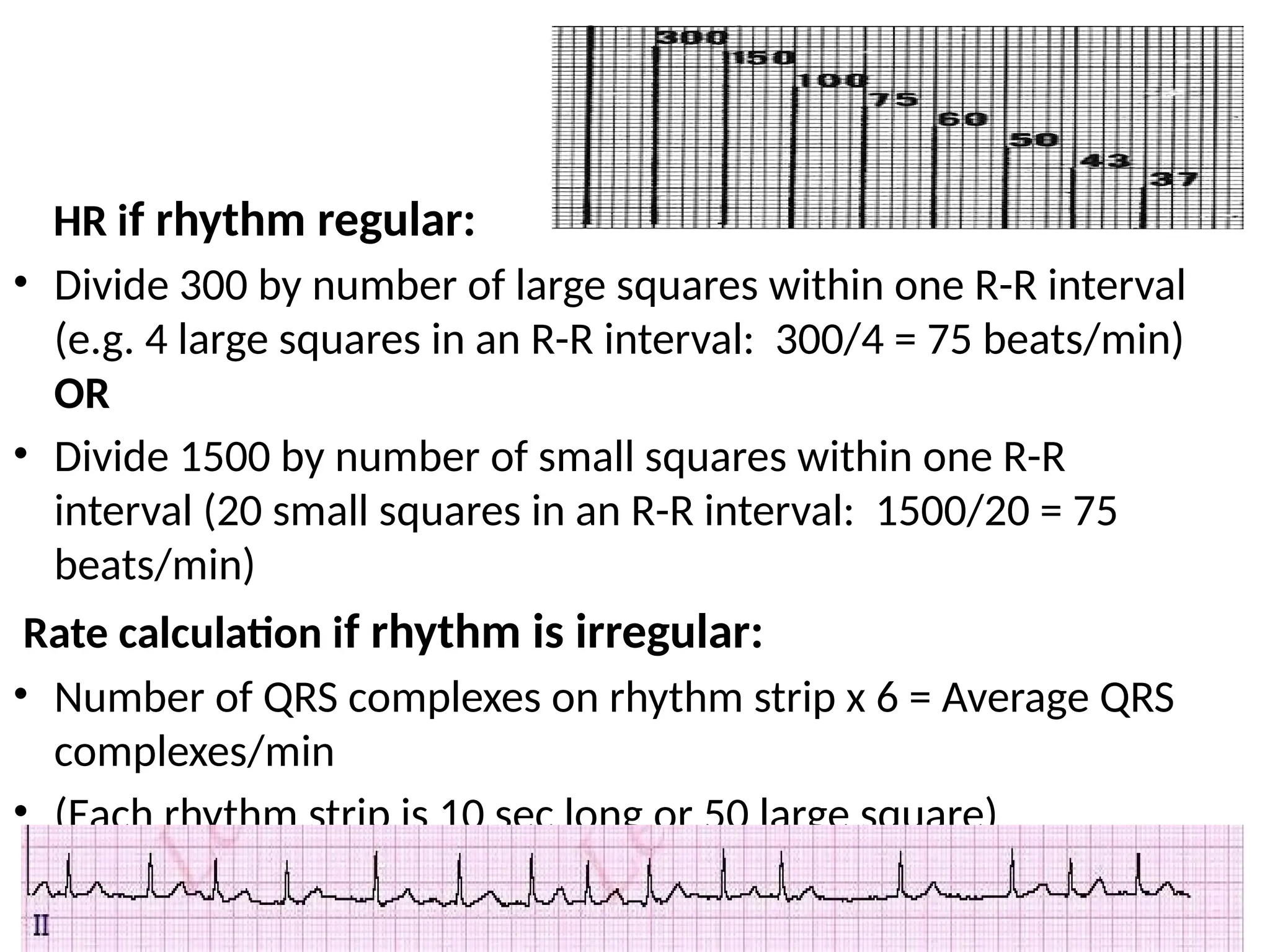 ECG_PRESENTATION by a doctor ecg overview | PPT