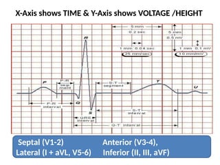 ECG_PRESENTATION by a doctor ecg overview | PPTX