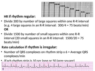 ECG_PRESENTATION by a doctor ecg overview | PPTX