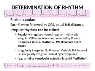 ECG_PRESENTATION by a doctor ecg overview | PPTX