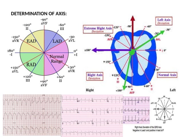 ECG_PRESENTATION by a doctor ecg overview | PPT
