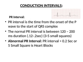 ECG_PRESENTATION by a doctor ecg overview | PPT