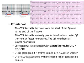 ECG_PRESENTATION by a doctor ecg overview | PPT