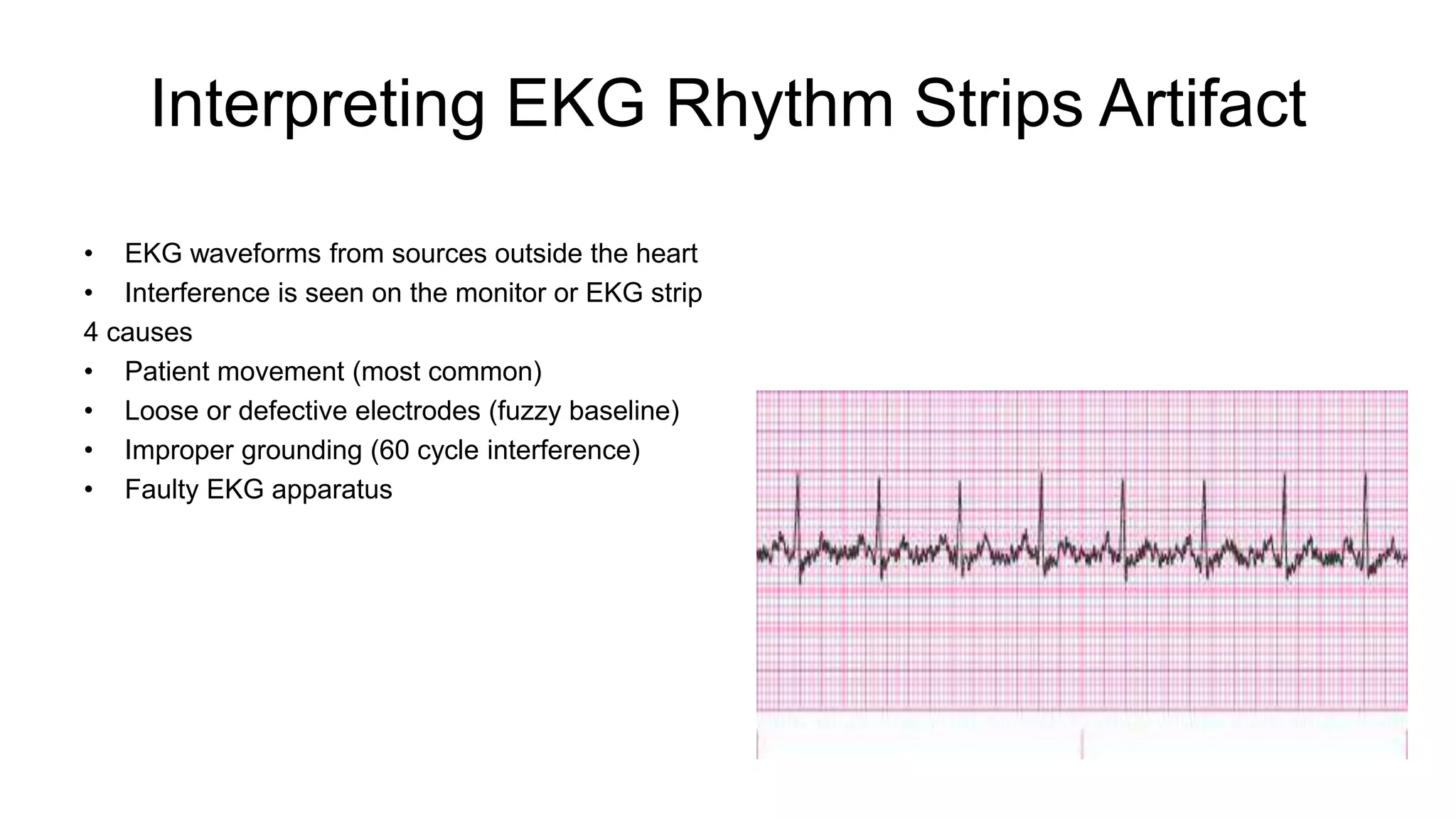 Ecg presentation1 | PPTX