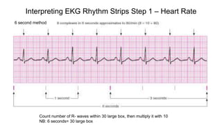 Ecg presentation1 | PPT