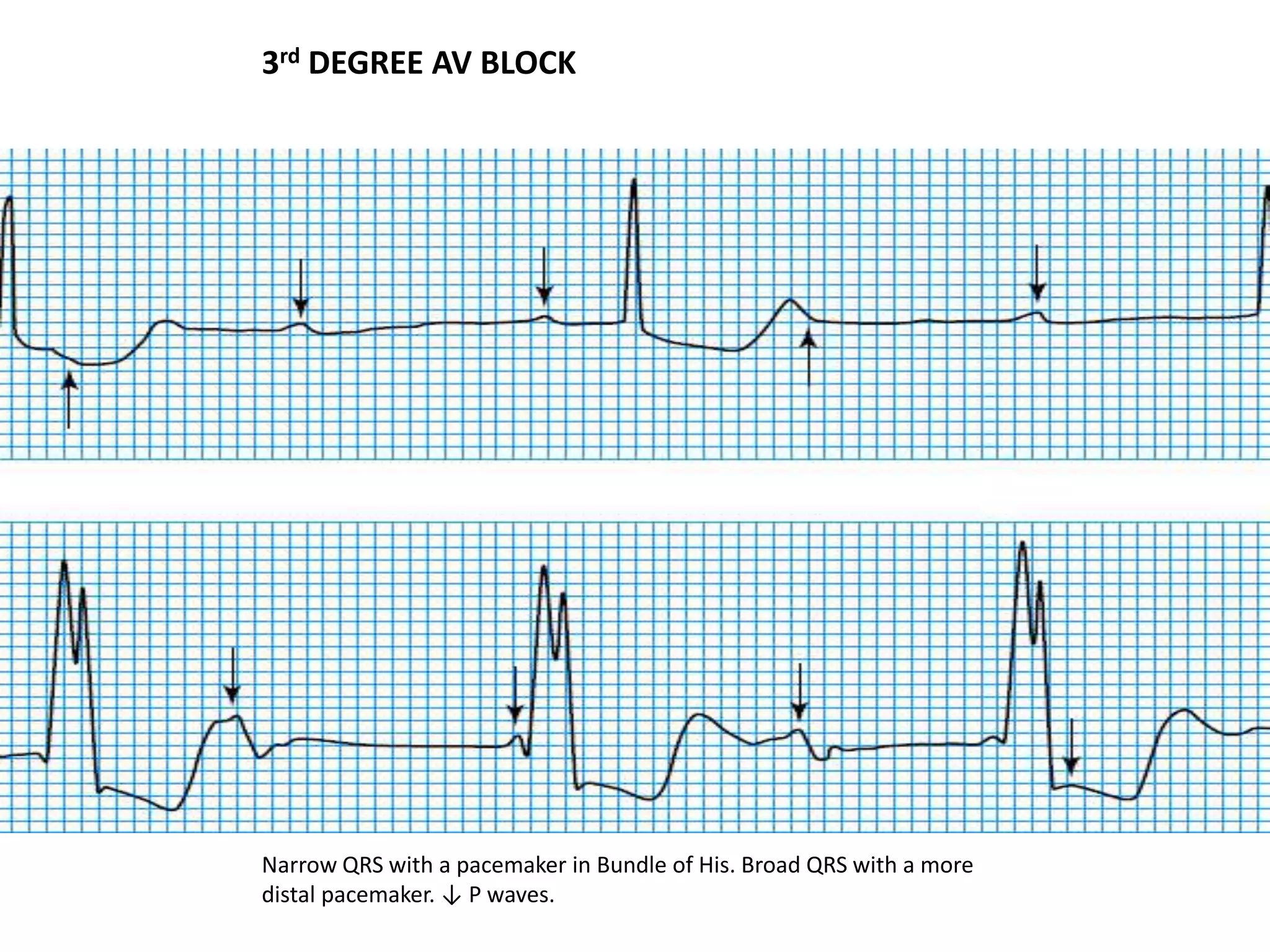 ecg Presentation1.pptx