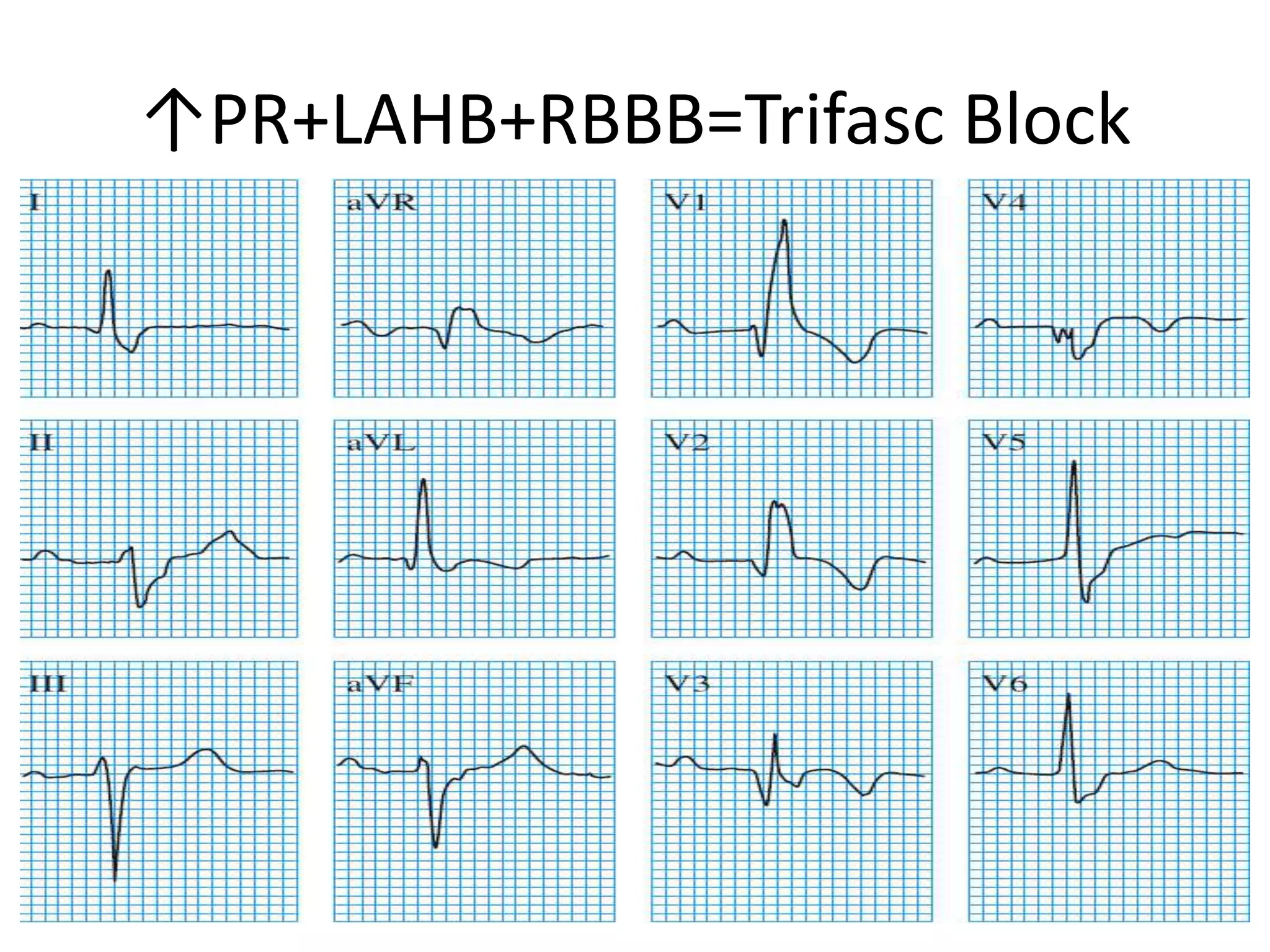 ecg Presentation1.pptx
