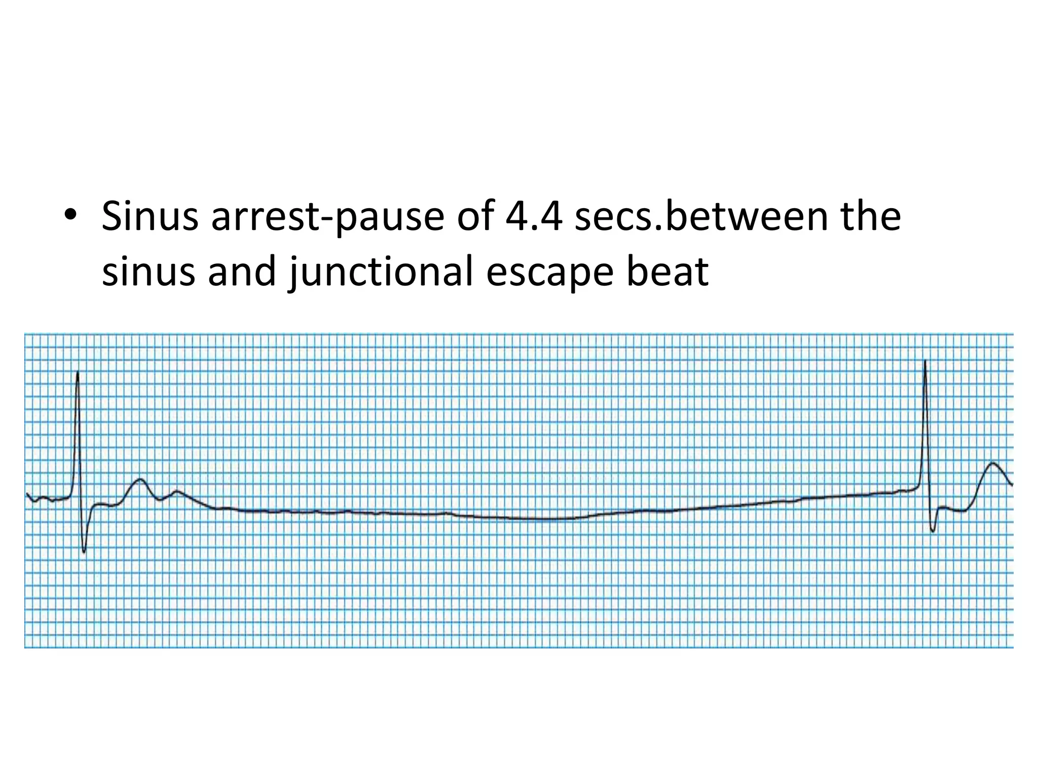 ecg Presentation1.pptx