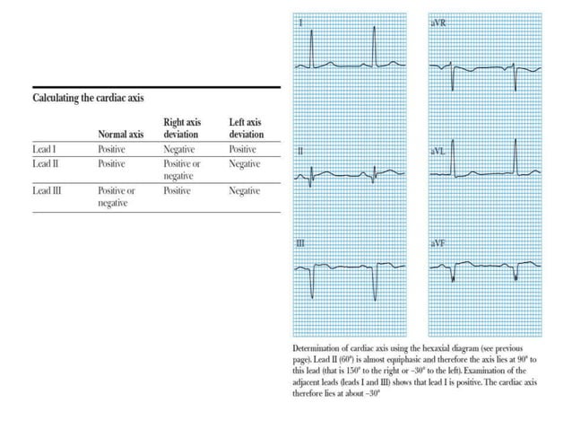 ecg Presentation1.pptx