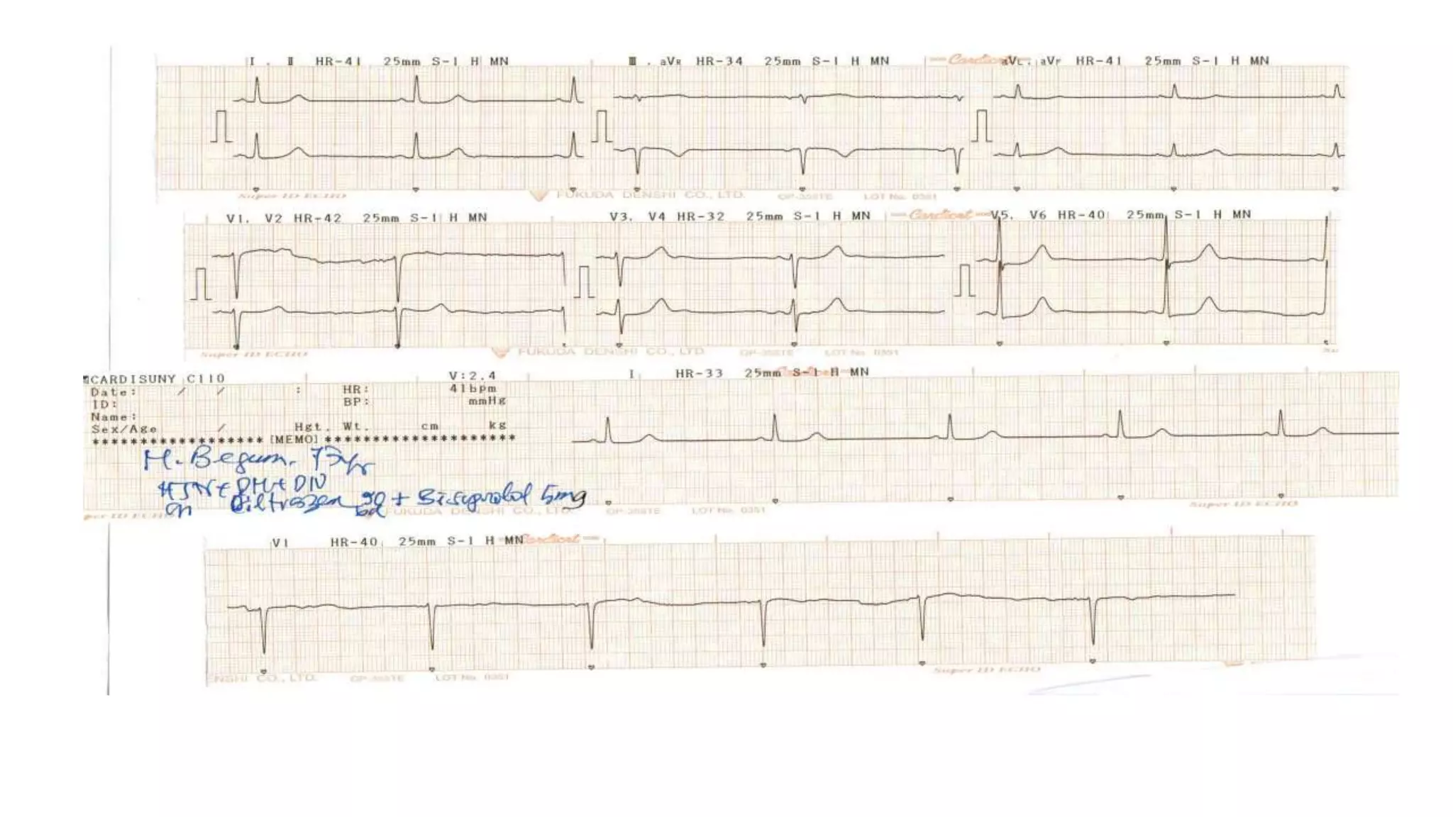 ECG Presentation by Dr Nasir Uddin | PPT