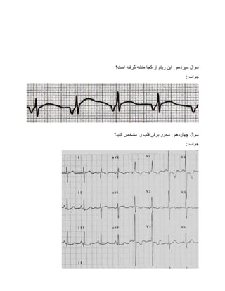 ECG Question | PDF