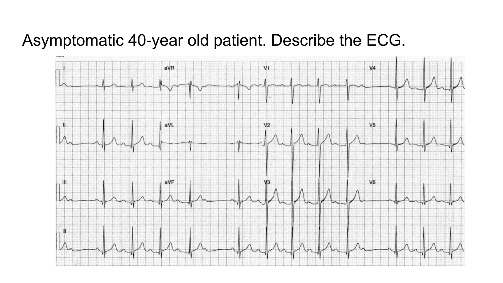 ELECTROCARDIOGRAPHY EXAMPLE questions.pptx