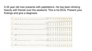 ELECTROCARDIOGRAPHY EXAMPLE questions.pptx