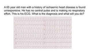 ELECTROCARDIOGRAPHY EXAMPLE questions.pptx