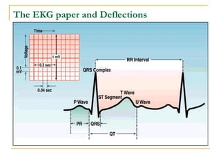 PowerPoint presentation of ECG Quick Reference.PPT