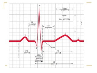 PowerPoint presentation of ECG Quick Reference.PPT