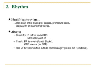 PowerPoint presentation of ECG Quick Reference.PPT