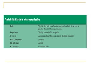 PowerPoint presentation of ECG Quick Reference.PPT