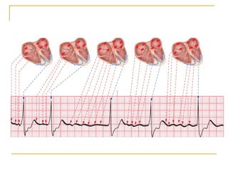 PowerPoint presentation of ECG Quick Reference.PPT