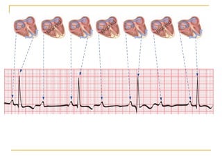 PowerPoint presentation of ECG Quick Reference.PPT