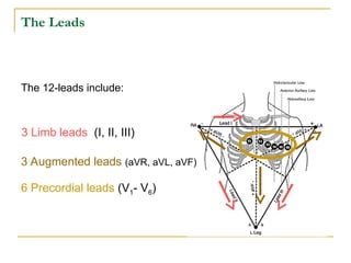 PowerPoint presentation of ECG Quick Reference.PPT