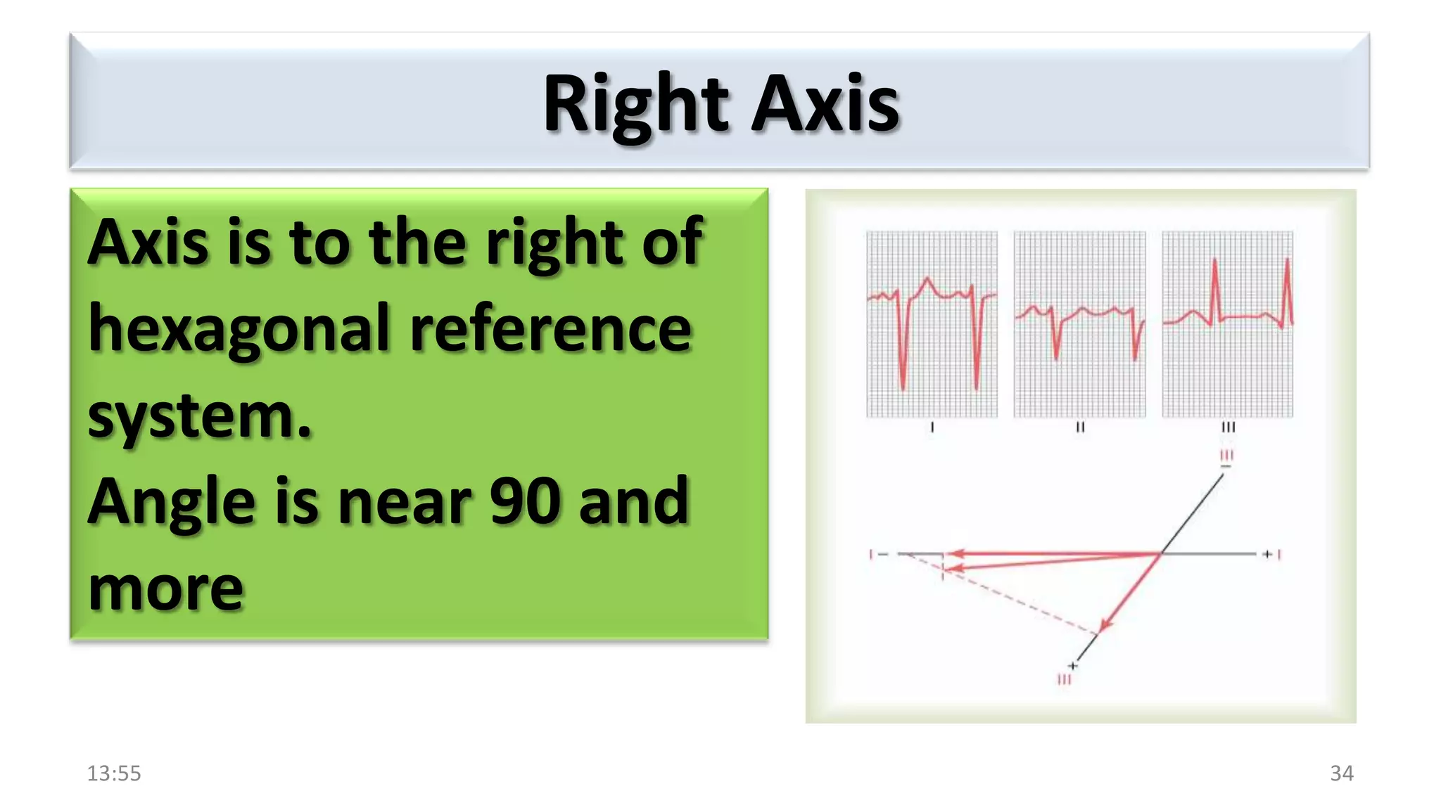Ecg reading | PPTX
