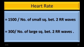 Ecg reading | PPTX