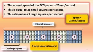 Ecg reading | PPTX