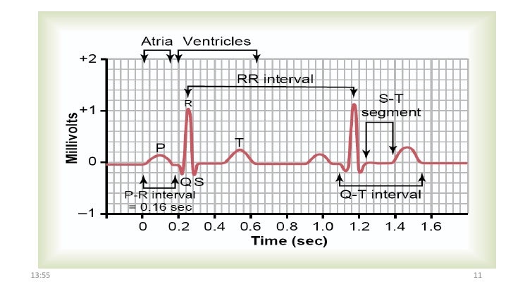 Ecg reading